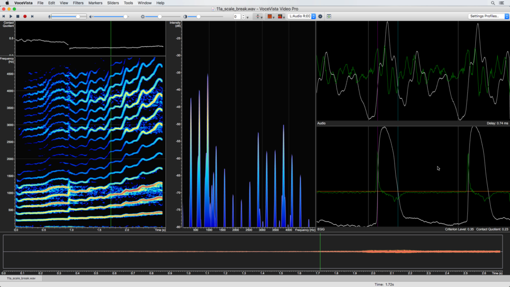 Video Tutorials – Sygyt Software