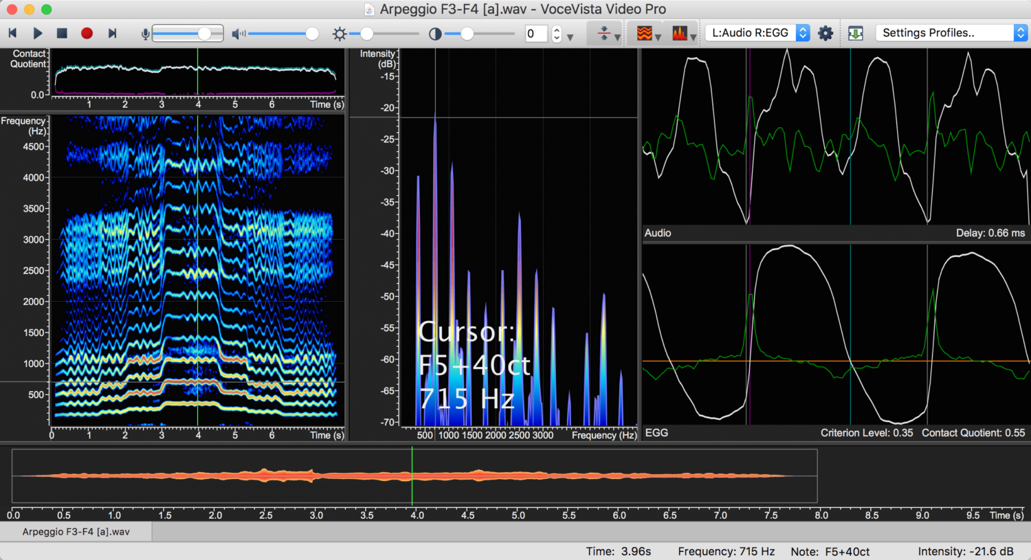 VoceVista Video 5.1.0 – Sygyt Software